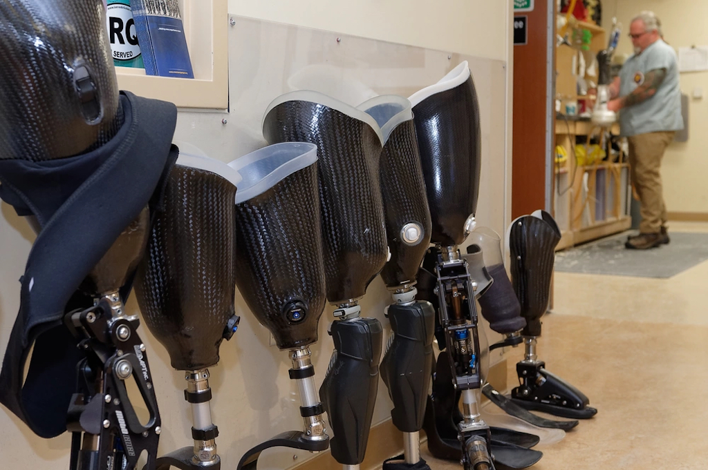 This is how American wars changed the course of prosthetics