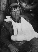 This is why 'shell shock' was redefined as Post Traumatic Stress Disorder