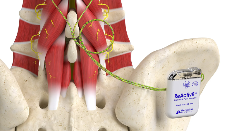 Do this every morning to relieve back pain