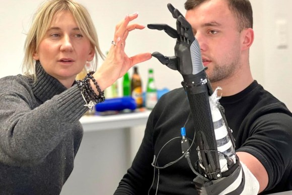 Wounded Ukrainian soldiers with bionic arms want to return to the front lines