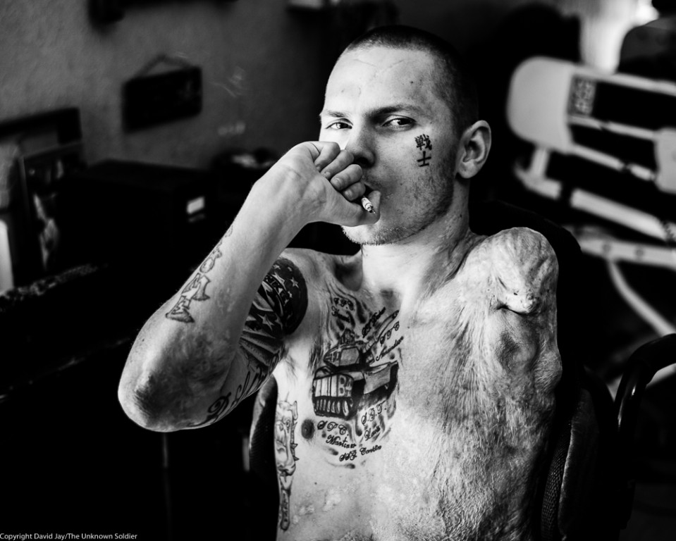 Everyone should see these powerful images of wounded vets